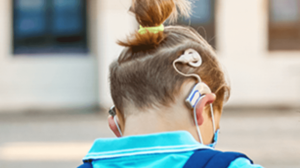 Cochlear Implant - European Union of the Deaf